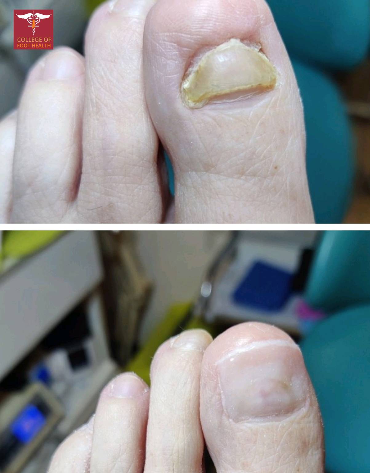 COFH Courses | College of Foot Health | COFH | Foot Health Practitioner ...